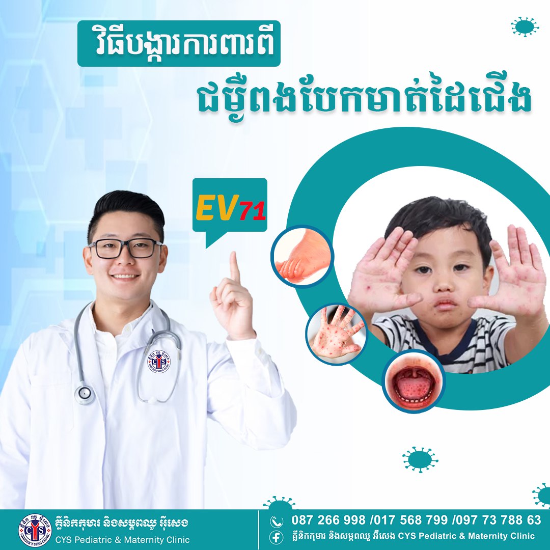វិធីបង្ការ និងការពារពីជម្ងឺពងបែកមាត់ដៃជើង (EV71)